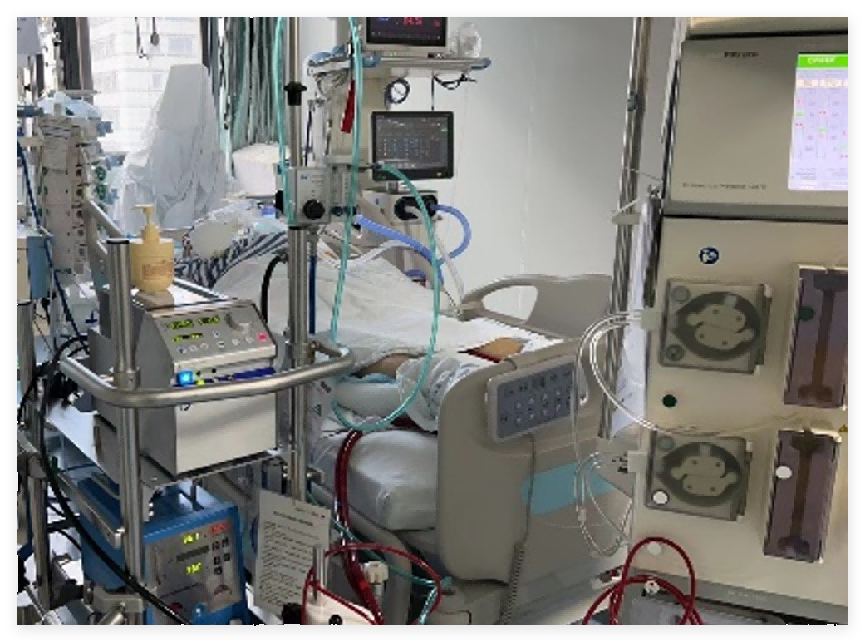 川北医学院附属医院：急性肺栓塞患者心脏骤停40分钟 ECMO团队再创生命奇迹_中国网