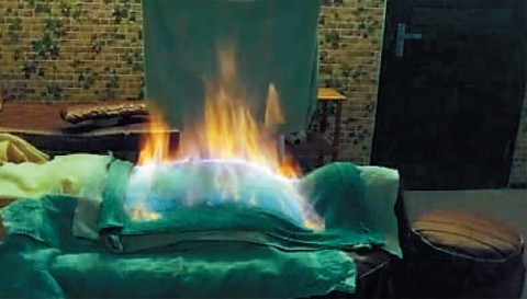 'Fire therapy' burns beauty salon's customers - China.org.cn