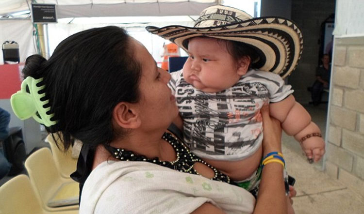 Colombian Obese Baby Weighs Almost 20kg - China.org.cn